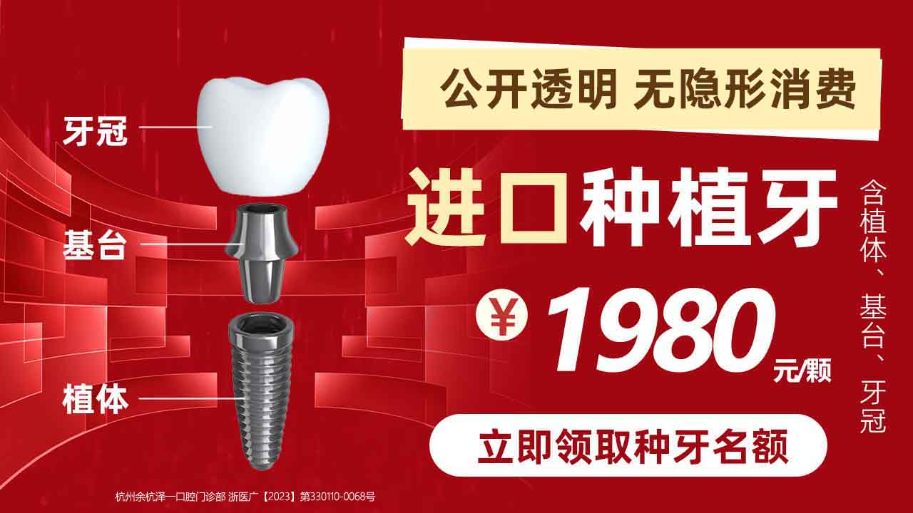 上午种牙下午轻饮食一颗牙才这个价